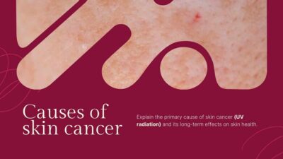 Skin Cancer. Free PPT & Google Slides Template — SlidesCarnival