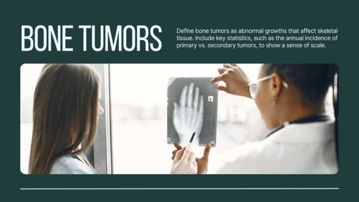 Approach To Bone Tumors. Free PPT & Google Slides Template — SlidesCarnival