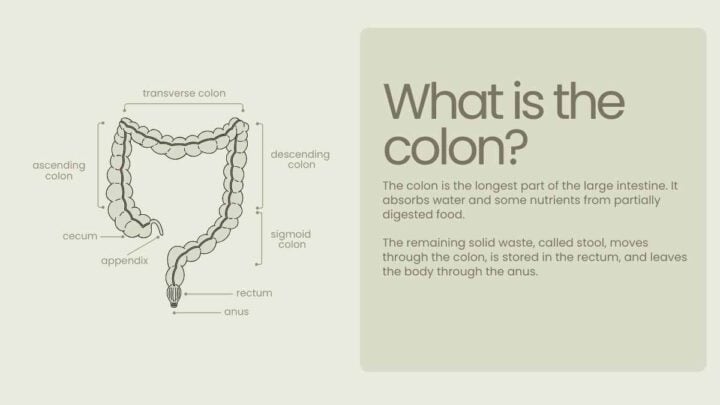 Colon Cancer. Slides Template — SlidesCarnival